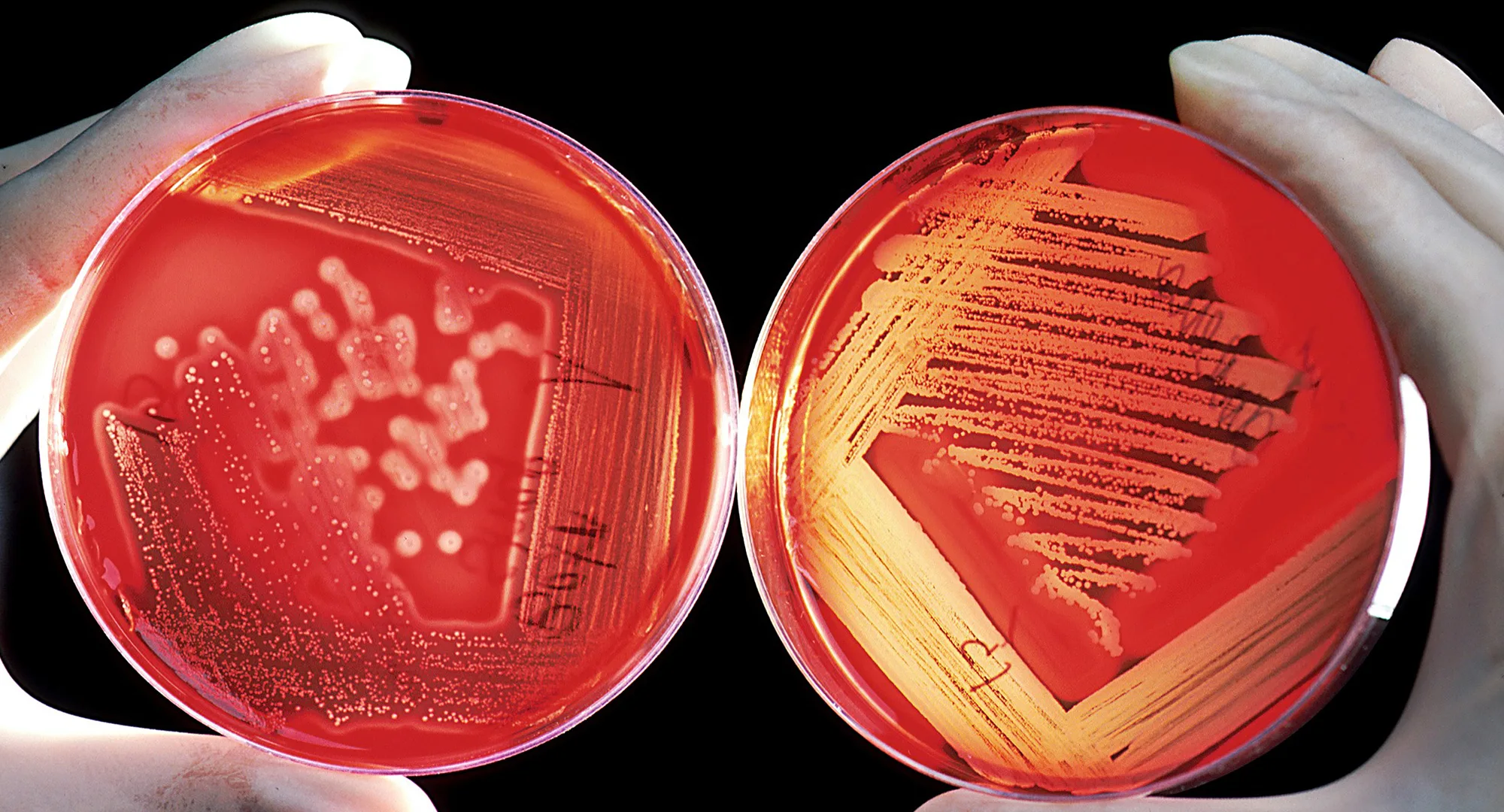 Master Microbiologie - FST de Nancy